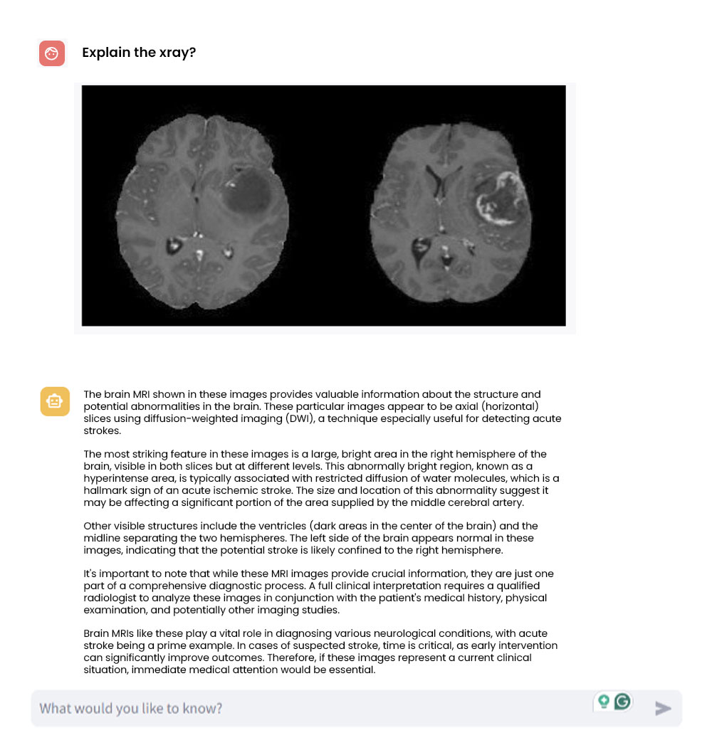 A Multi-Model Multi-Agent System for Healthcare Audit and Denial ...